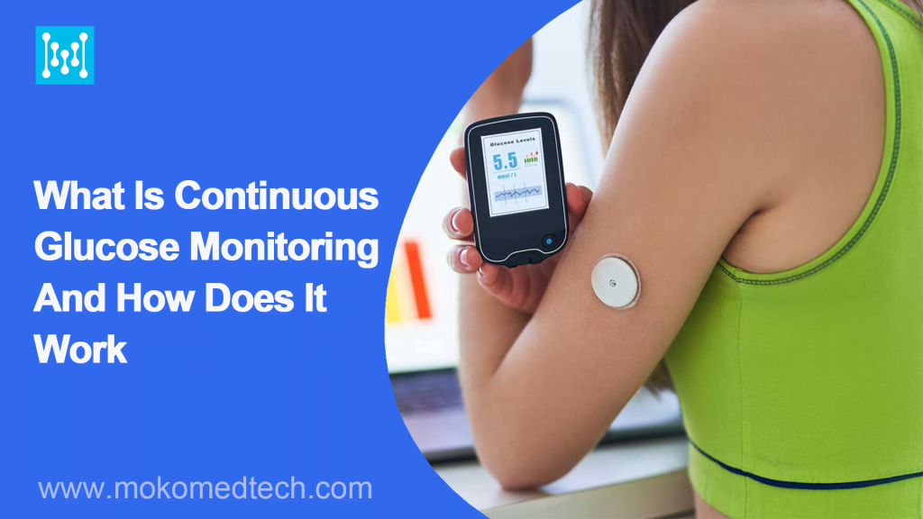 How Does A Continuous Glucose Monitor Work Aptiva Med - vrogue.co How Does A Continuous Glucose Monitor Work Aptiva Med - vrogue.co